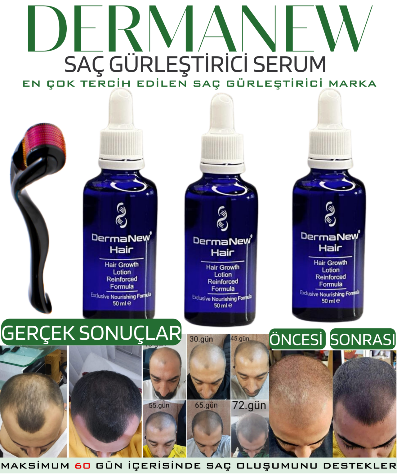 Dermanewhair - Saçlarınız Dökülmesin, Çogalsın